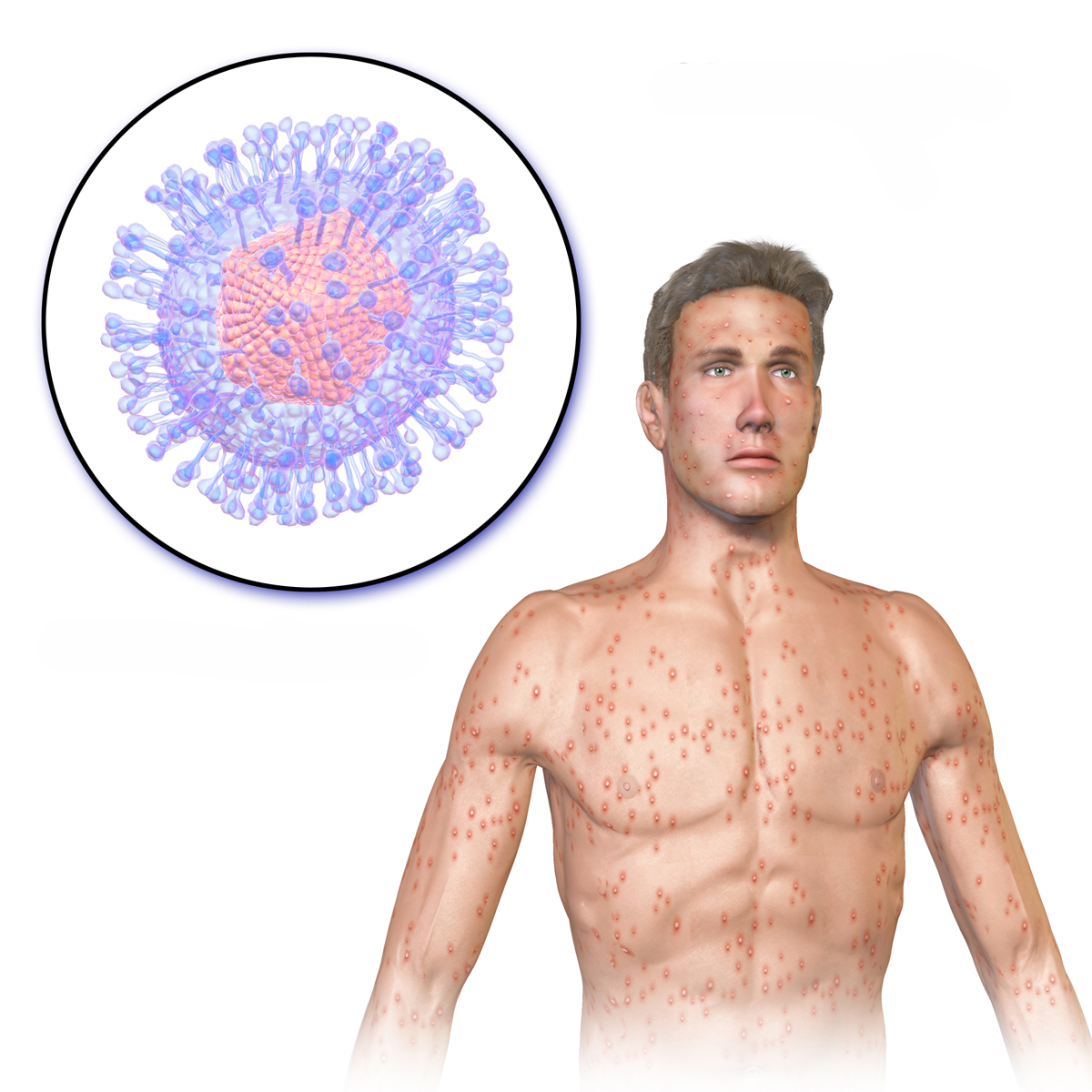 Hepatitis and chicken pox — lesson. Science State Board, Class 7.