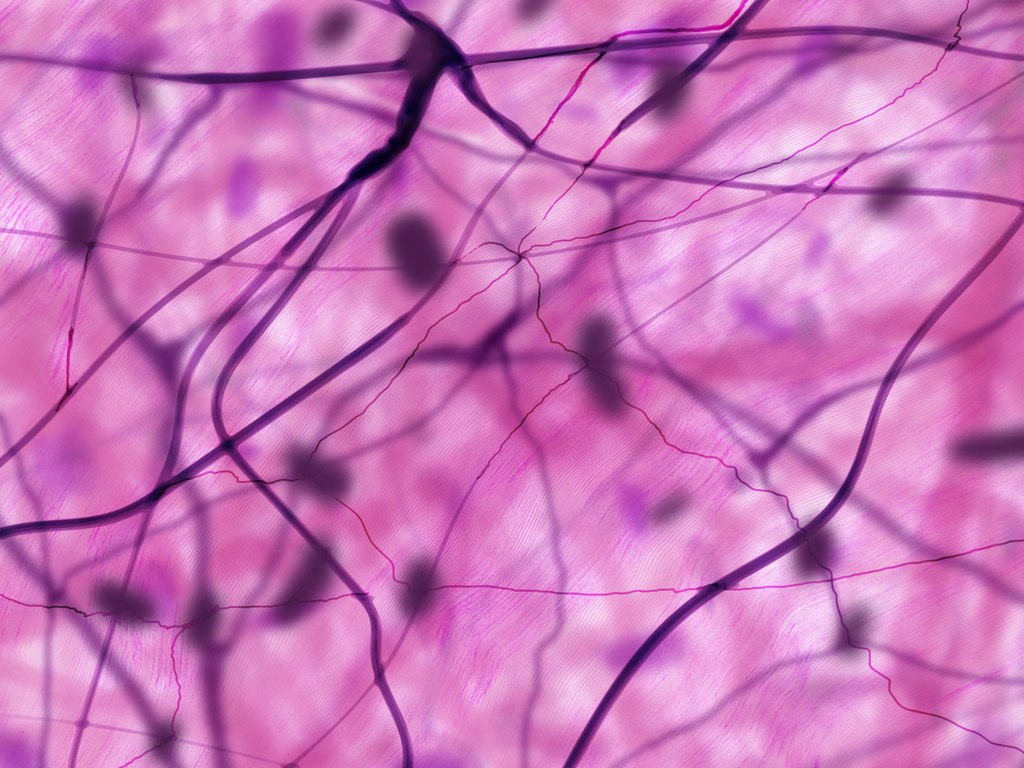 Connective tissue - Introduction — lesson. Science CBSE, Class 9.