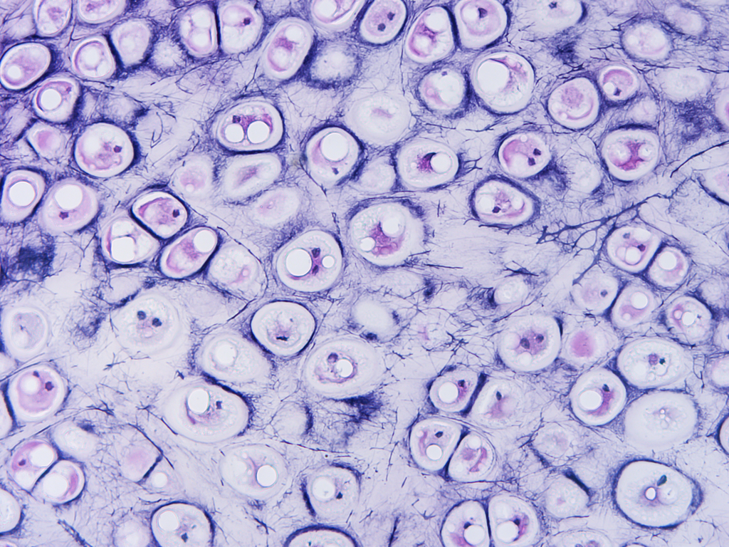 Supportive connective tissue - I — lesson. Science CBSE, Class 9.