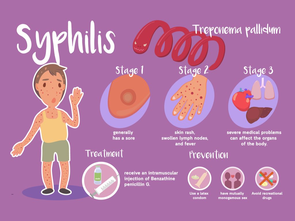 Sexually transmitted diseases by bacteria and virus — lesson. Science ...