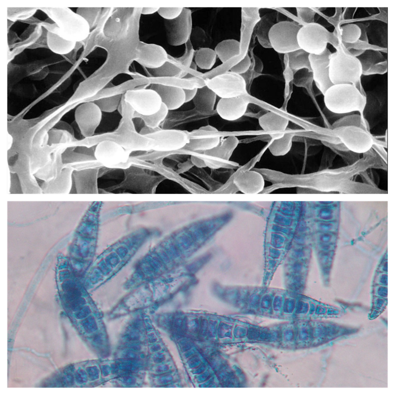 Infectious agents — lesson. Science State Board, Class 7.
