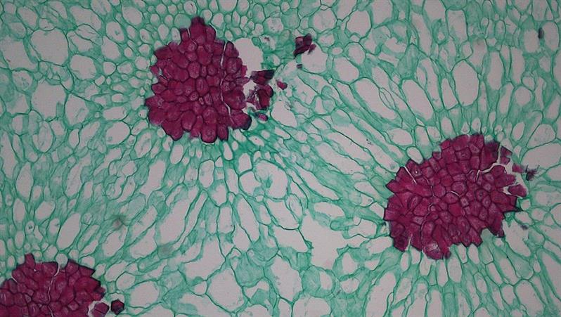 Collenchyma and Sclerenchyma — lesson. Science State Board, Class 9.
