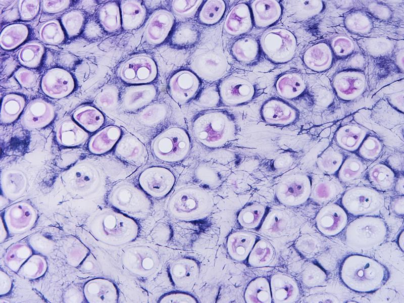 Supportive connective tissue — lesson. Science State Board, Class 9.