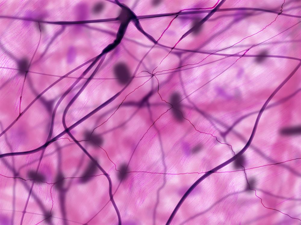 Connective tissue - Introduction — lesson. Science CBSE, Class 9.