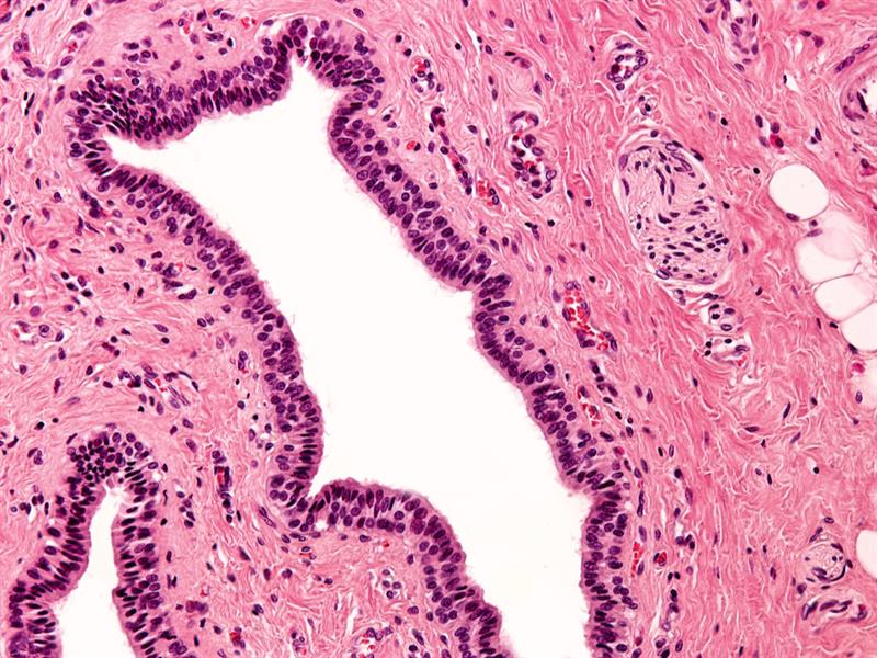 Stratified epithelium — lesson. Science CBSE, Class 9.