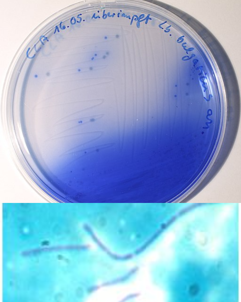 Nutrition in bacteria — lesson. Science State Board, Class 9.